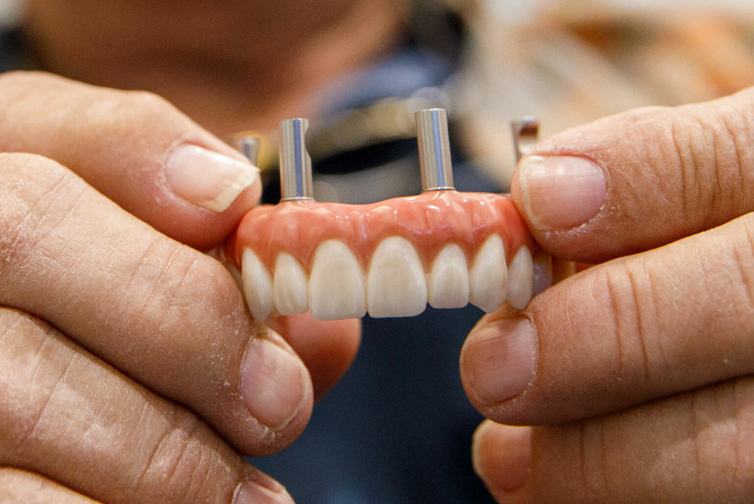 Blue Sky Dental Group Dentist Jacksonville FL blue-sky-dental-group-dentist-jacksonville-fl